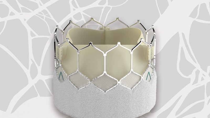 Transcatheter Aortic Valve Replacement (TAVR) | Springhill Medical Center