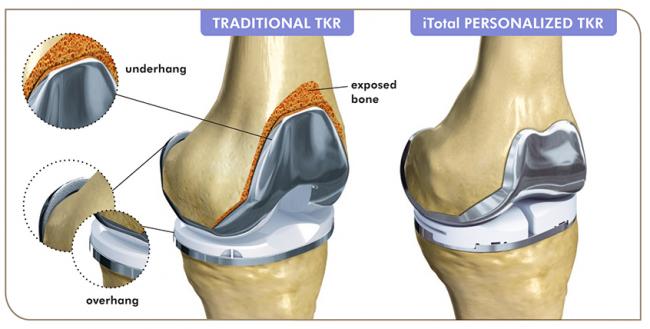 ConforMIS | Springhill Medical Center